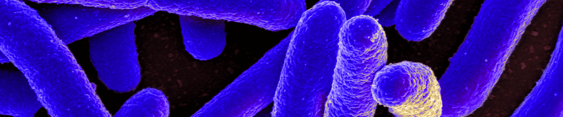 Émergence d’une nouvelle classe de souches uropathogènes de Escherichia ...